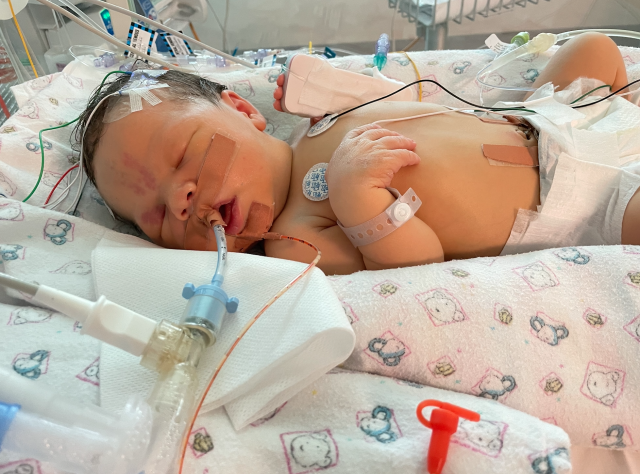 Baby stroke survivor Donald is a little superhero - Central Queensland ...